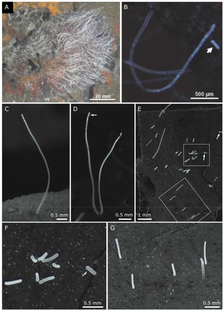 Thiomargarita magnifica: la bacteria más grande jamás descubierta - Morbeb